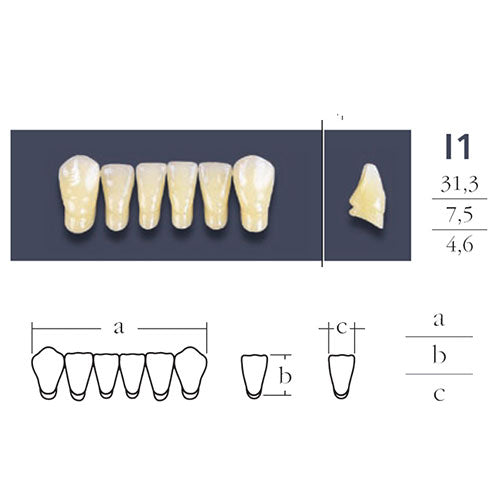 Cross Linked 2 teeth 2 anterior low - I1 shape Vita shades of your cho